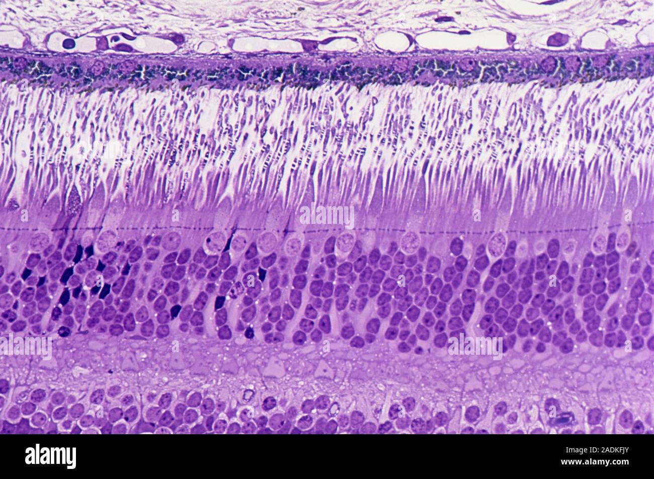 Human retina. Light micrograph of the retina of the human eye. The ...