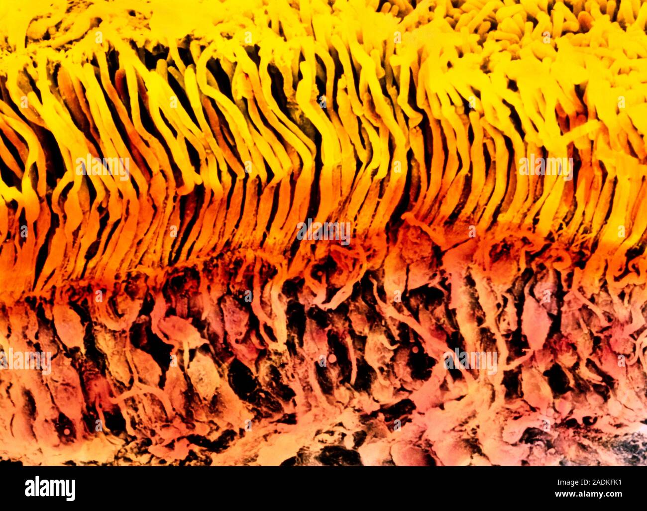 Retinal cells. Coloured Scanning Electron Micrograph (SEM) of a section ...