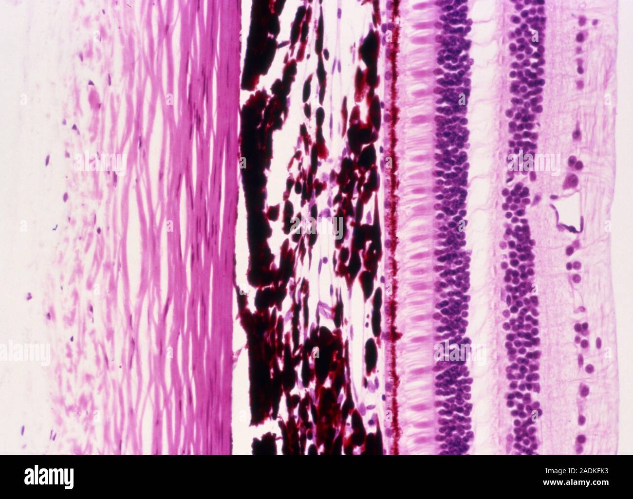 Eye wall. Light micrograph of a cross section through the eye wall. The ...