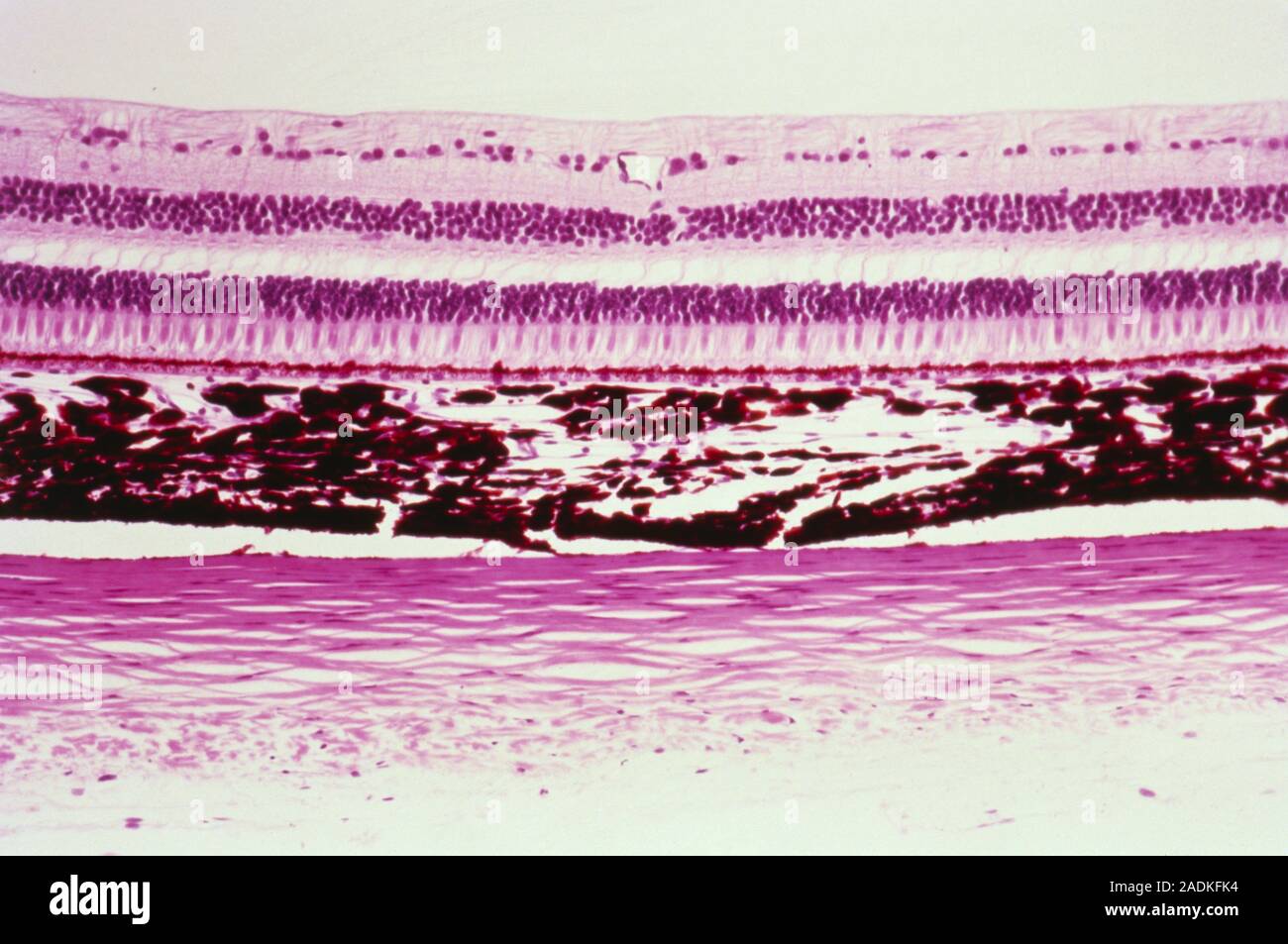 Eye wall. Light micrograph of a cross section through the eye wall. The ...