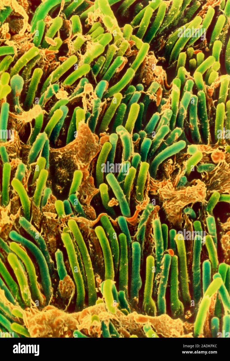 Rod cells. Coloured scanning electron micrograph (SEM) of a group of ...