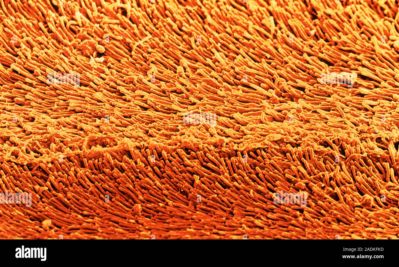 Rod cells. Coloured scanning electron micrograph (SEM) of a group of ...