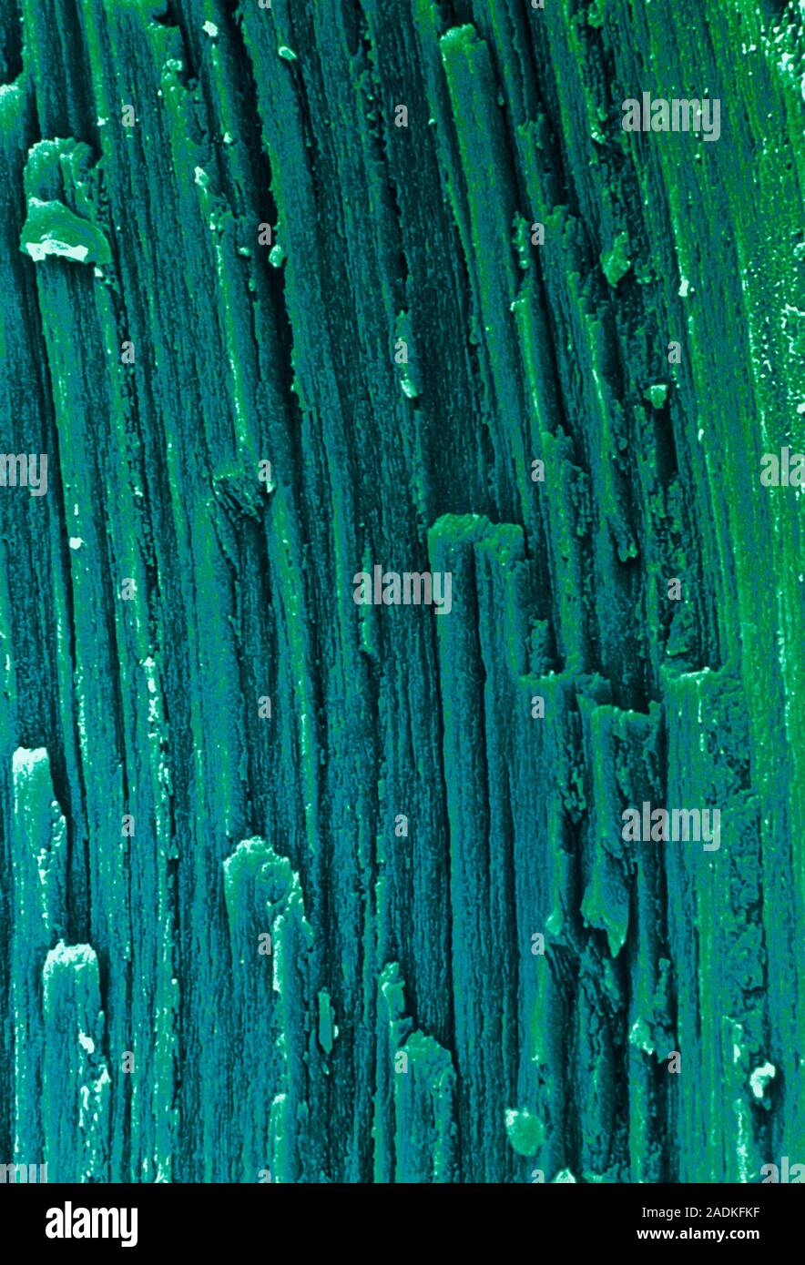 Eye lens. Coloured scanning electron micrograph (SEM) of the fibre-like ...