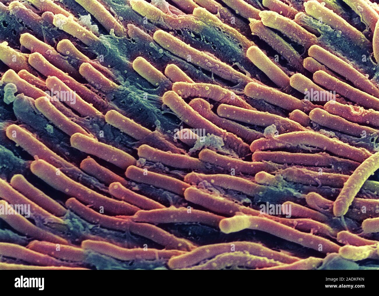 Rod cells. Coloured scanning electron micrograph (SEM) of rod cells ...