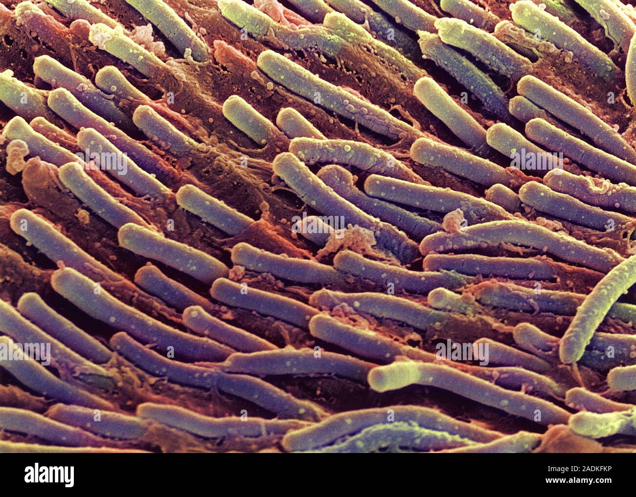 Rod cells. Coloured scanning electron micrograph (SEM) of rod cells ...
