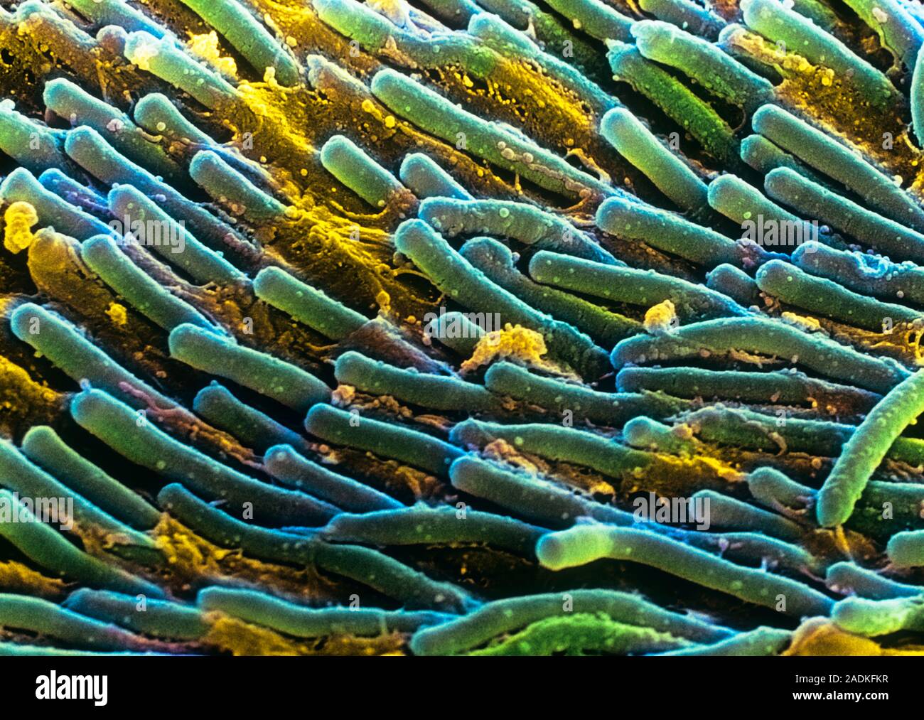 Rod cells. Coloured scanning electron micrograph (SEM) of rod cells ...