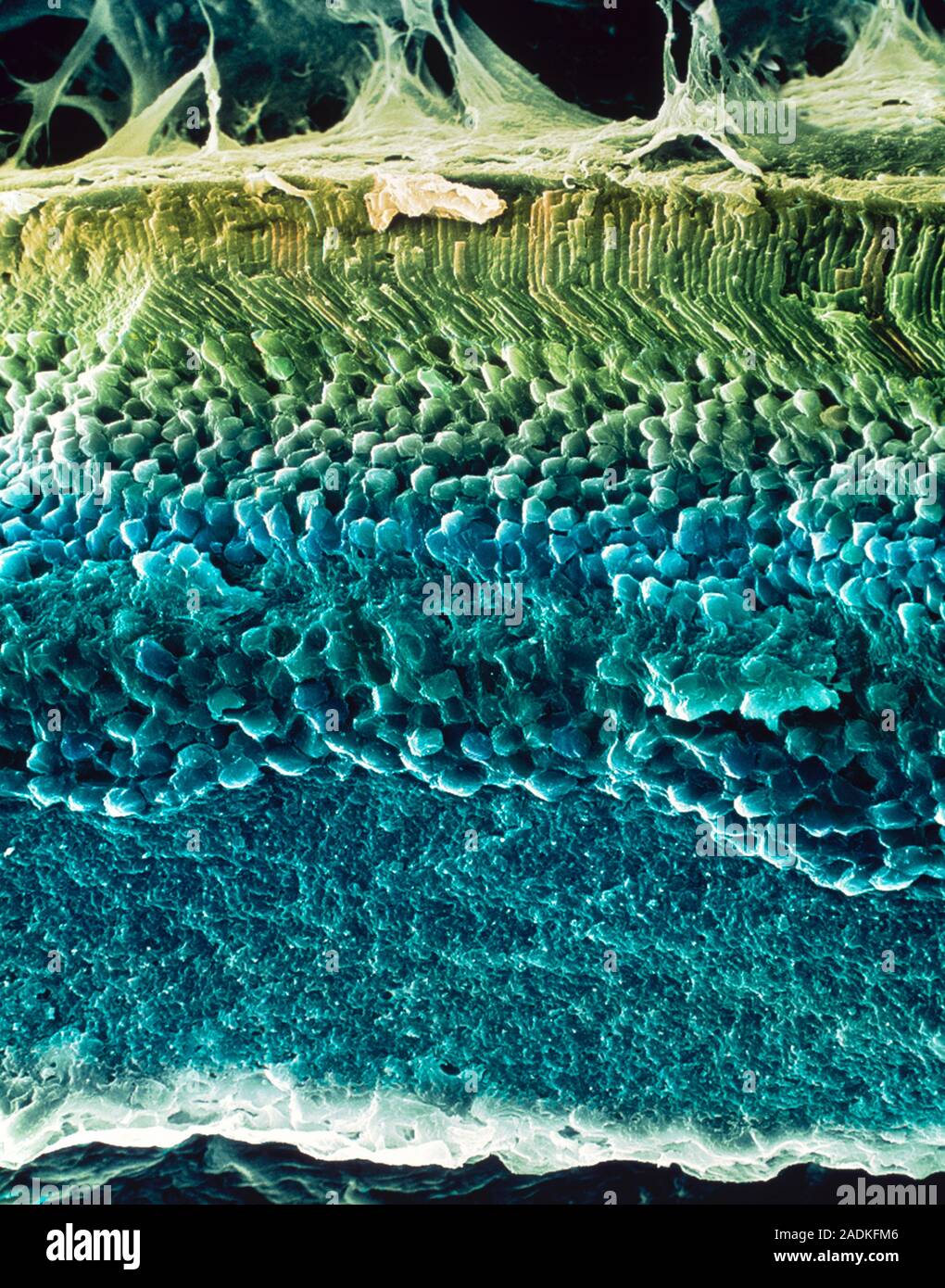 Retina Coloured Freeze Fracture Scanning Electron Micrograph Sem Of The Layers Of The Retina