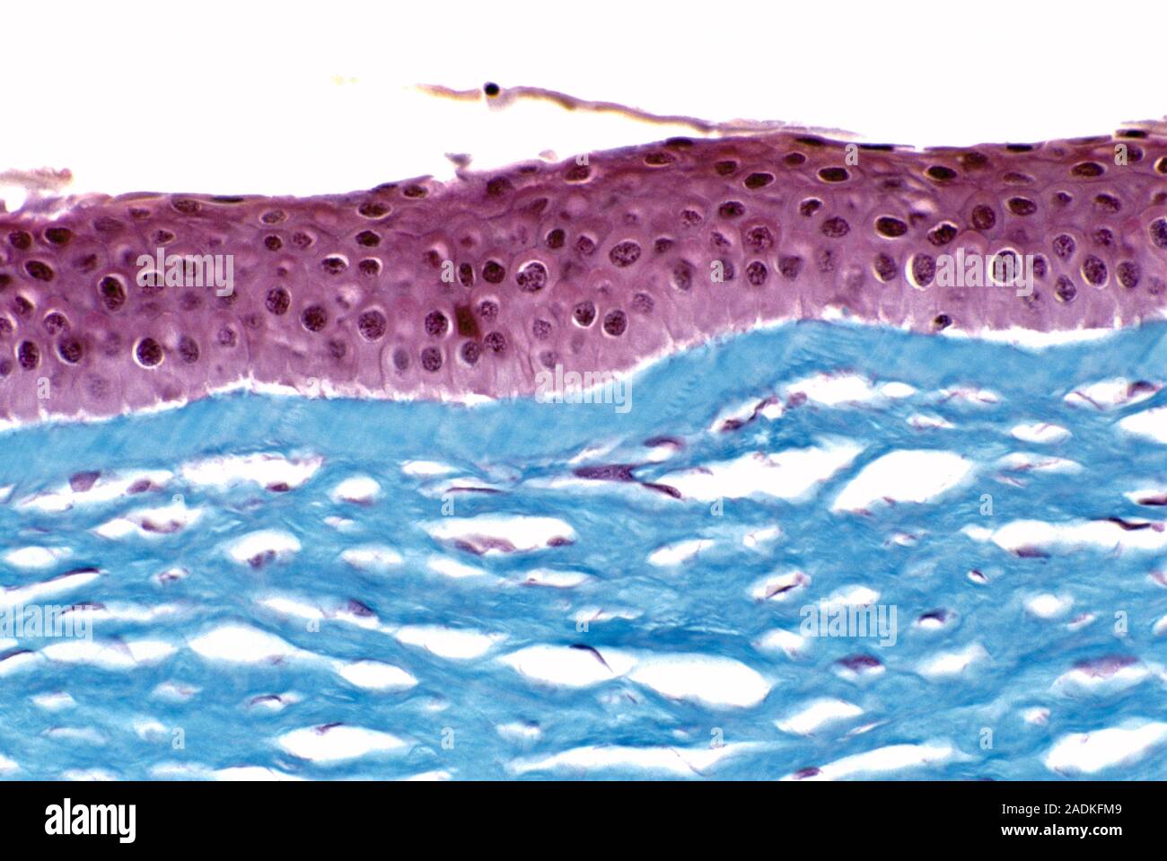 Cornea. Light micrograph of a section through a cornea, the transparent ...