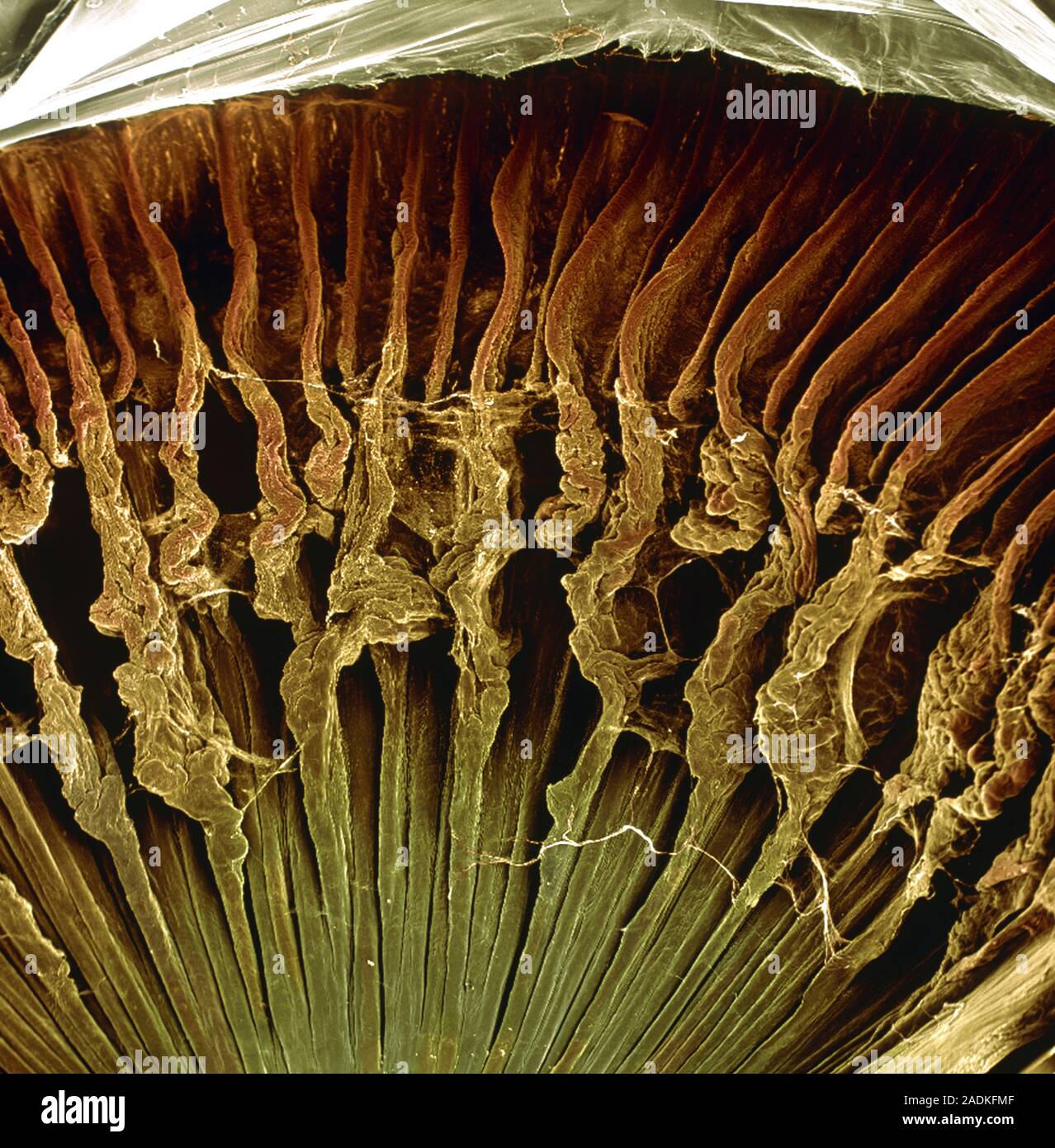 Ciliary body. Coloured scanning electron micrograph (SEM) of a section ...