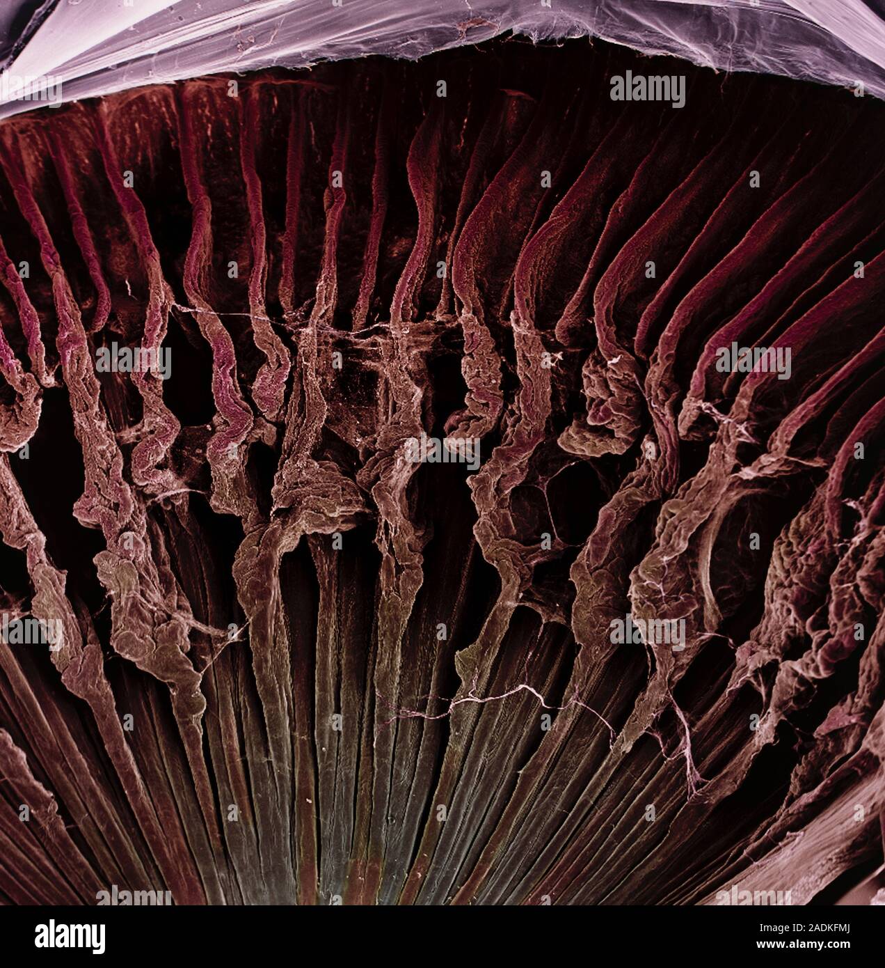 Ciliary body. Coloured scanning electron micrograph (SEM) of a section ...