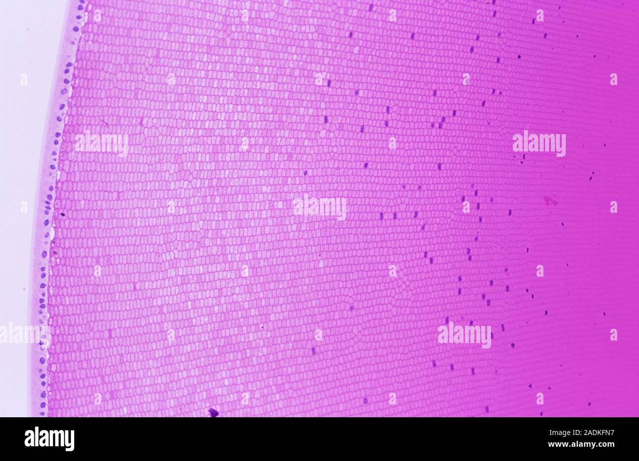 Eye lens fibres. Light micrograph of a section through the lens of an ...