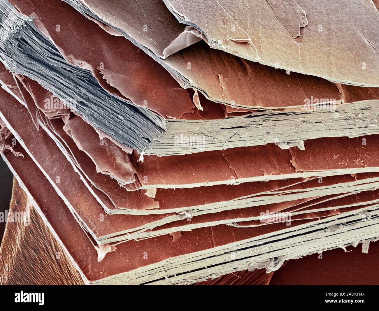 Eye lens. Coloured scanning electron micrograph (SEM) of a freeze ...
