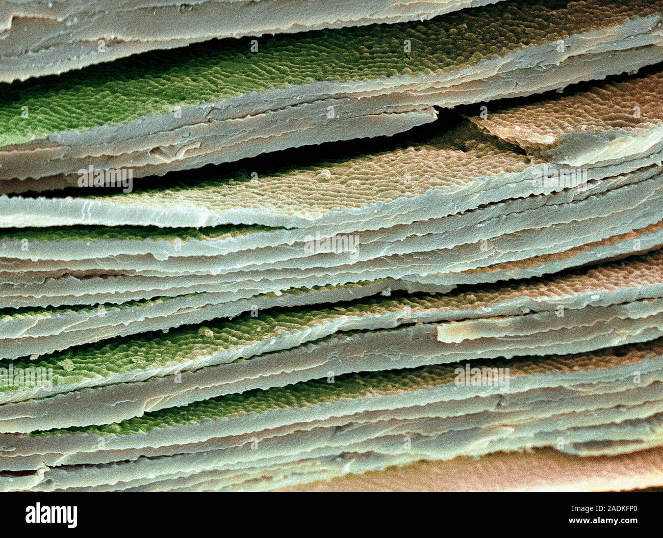 Eye lens. Coloured scanning electron micrograph (SEM) of a freeze ...