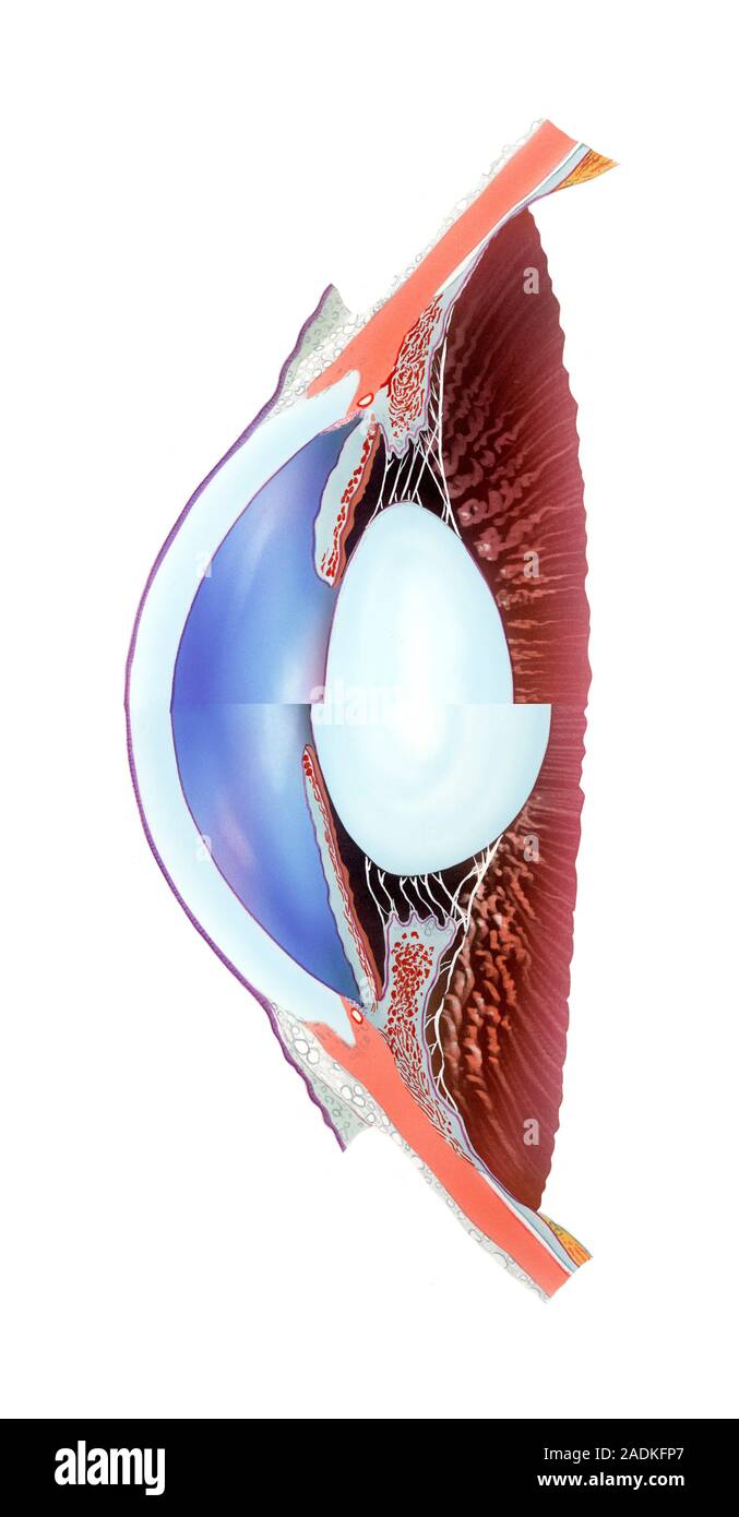Focusing of the eye. Artwork of a section through the eye showing ...