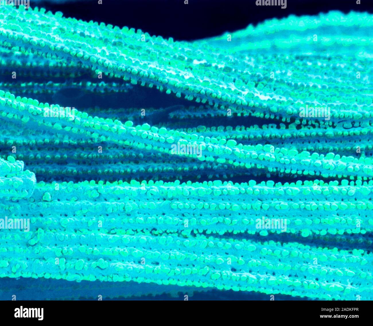 Eye lens. Coloured scanning electron micrograph (SEM) of cells from the ...