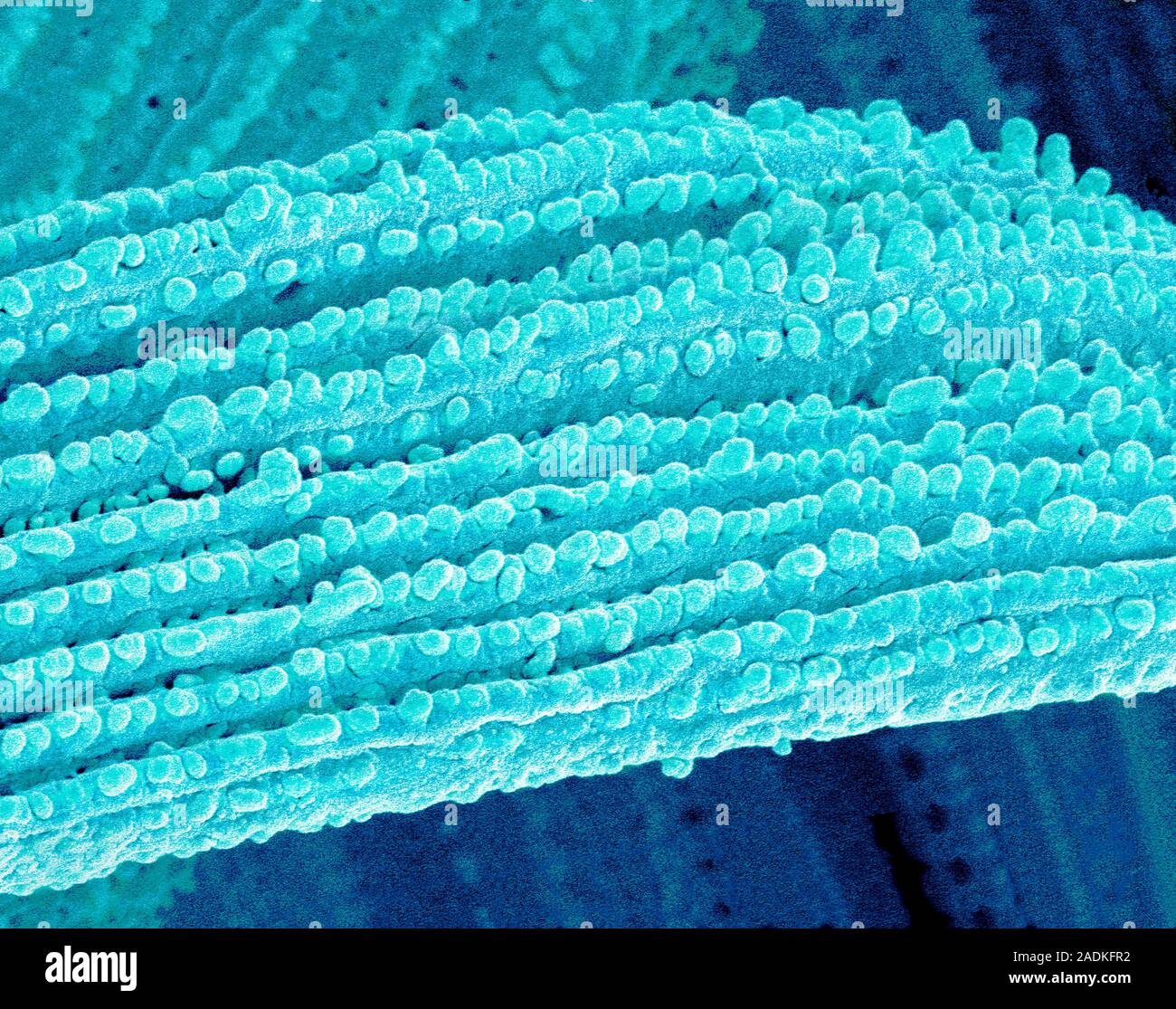 Eye lens. Coloured scanning electron micrograph (SEM) of cells from the ...