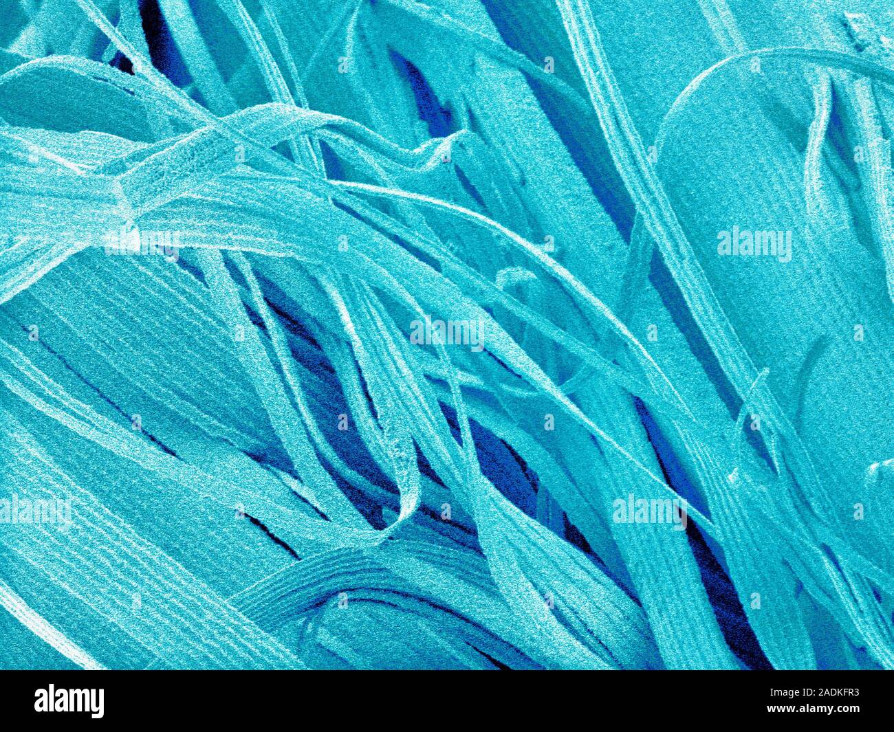 Eye lens. Coloured scanning electron micrograph (SEM) of cells from the ...