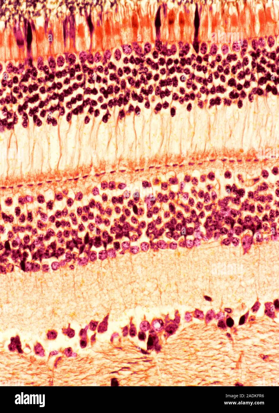 Retina. Coloured light micrograph of a section through a retina. The ...