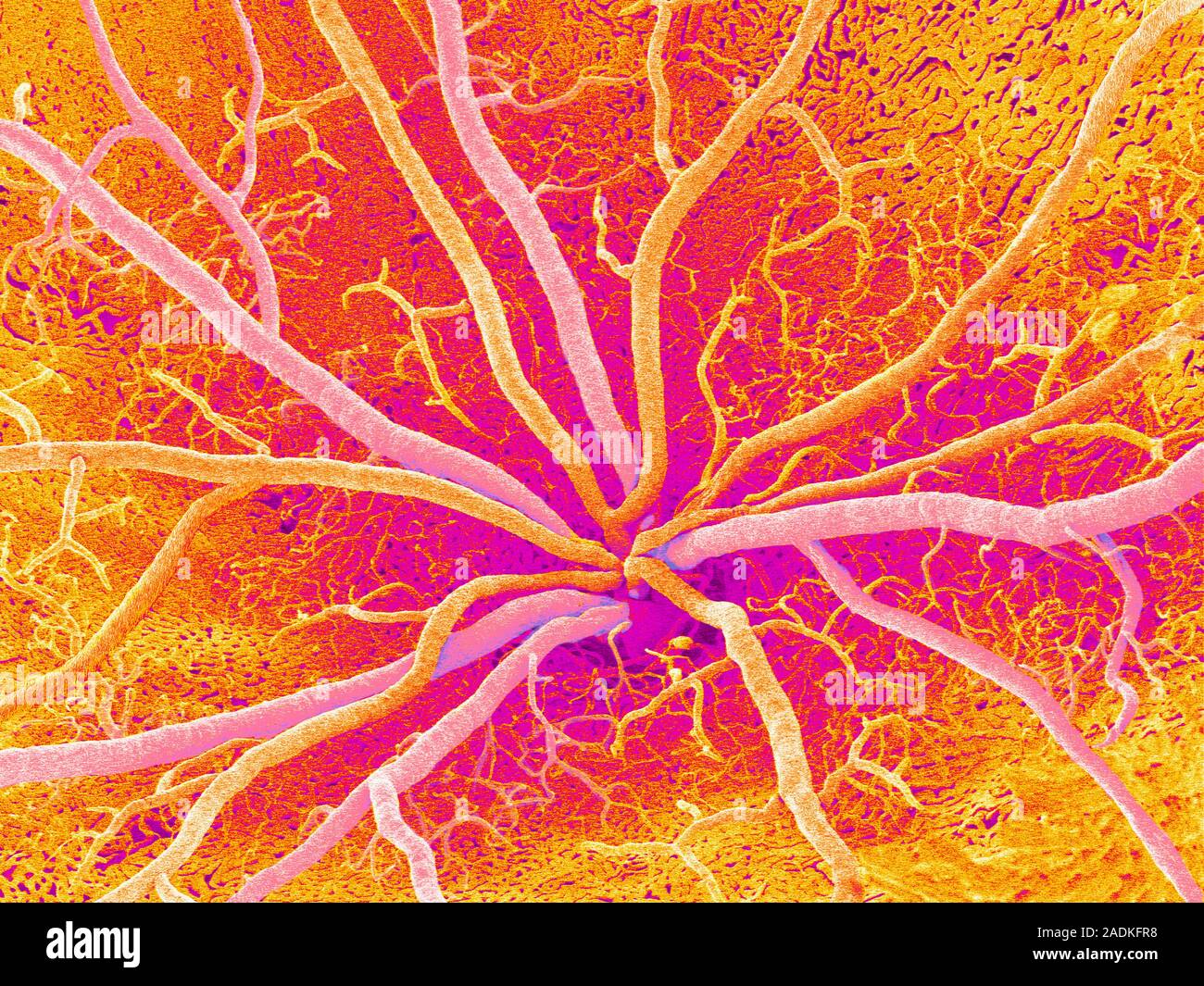 Retina blood vessels, coloured scanning electron micrograph (SEM). The ...