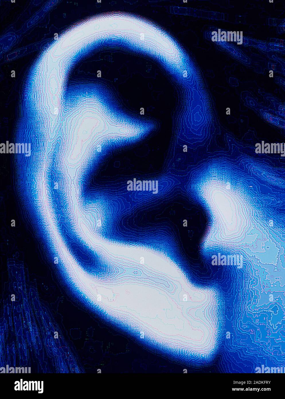 Ear pinna. Coloured computer graphic (with contour lines) of the human ...