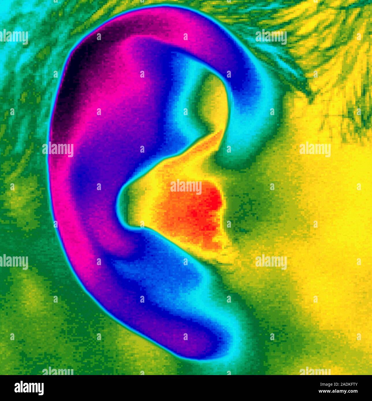 Human ear. Thermogram of a close-up view of a man's ear, showing ...