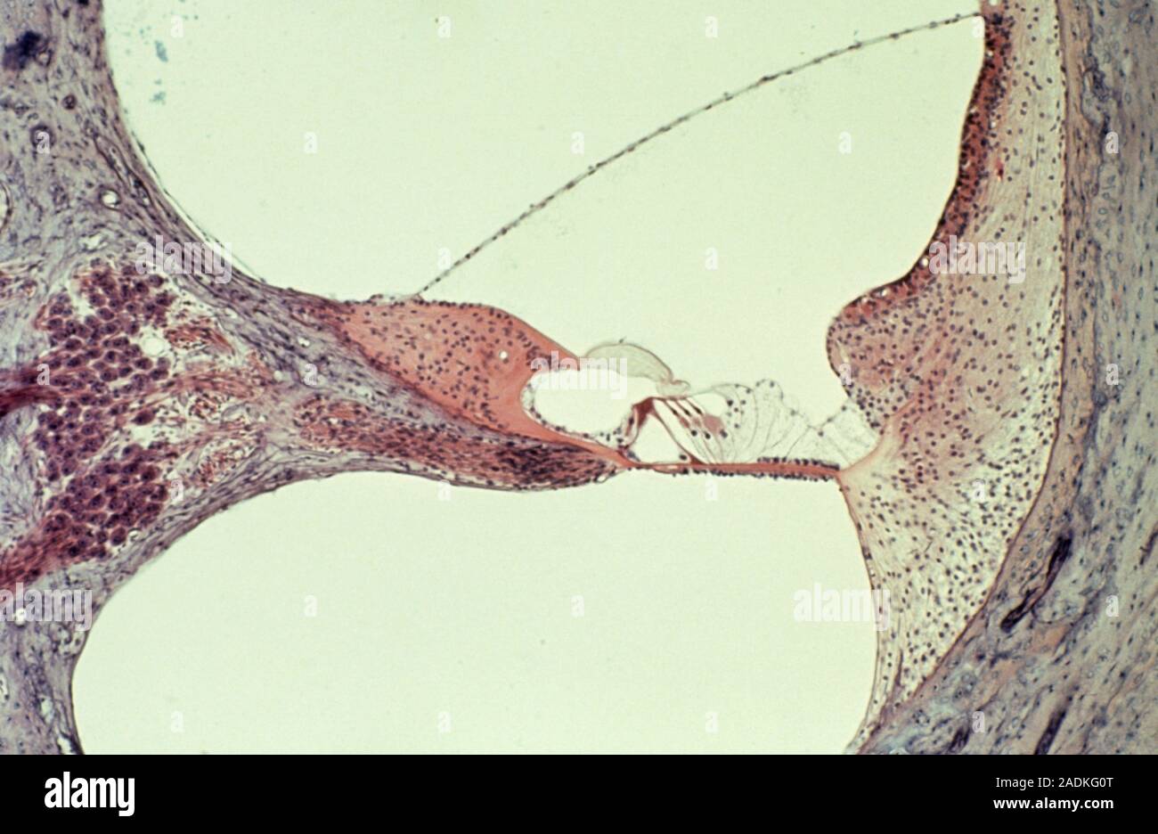 Cochlea of ear. Light micrograph of a cross section through the fluid ...