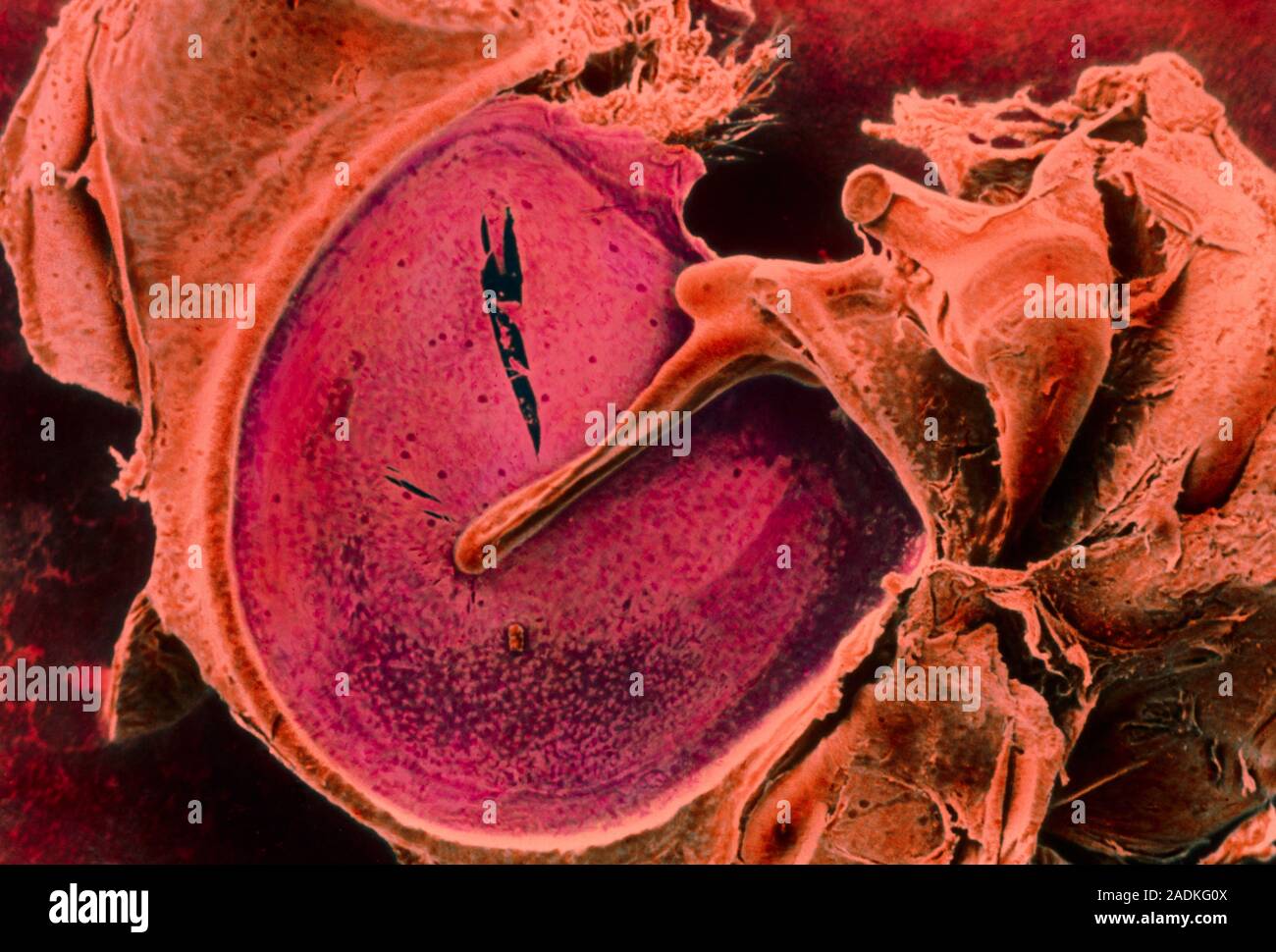 Eardrum and ossicles. Coloured scanning electron micrograph (SEM) of ...