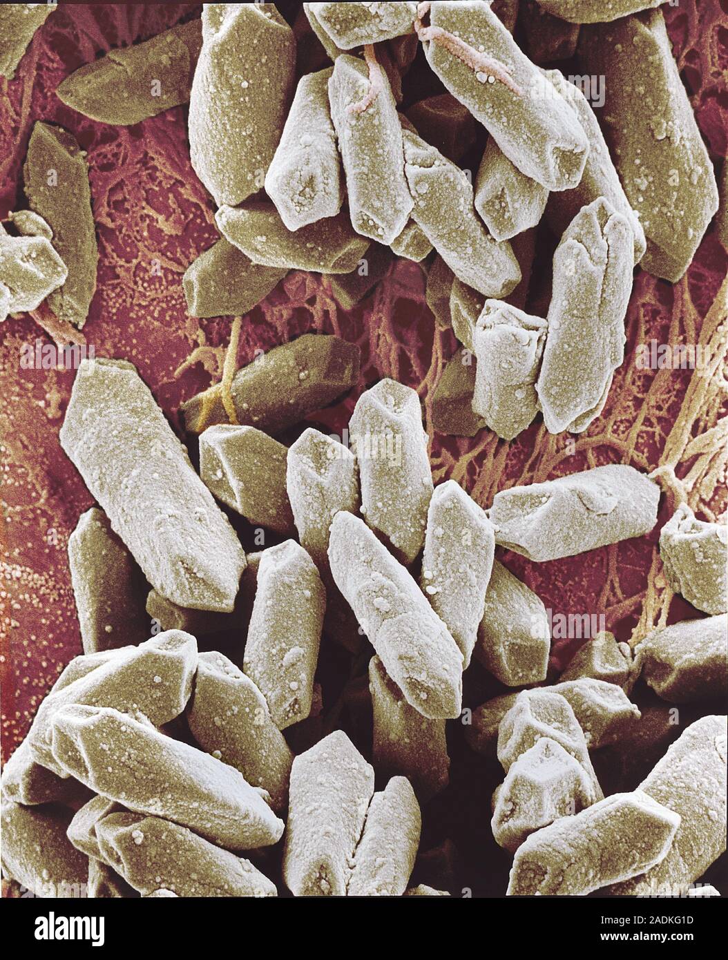 Balancing stone from inner ear. Coloured scanning electron micrograph ...