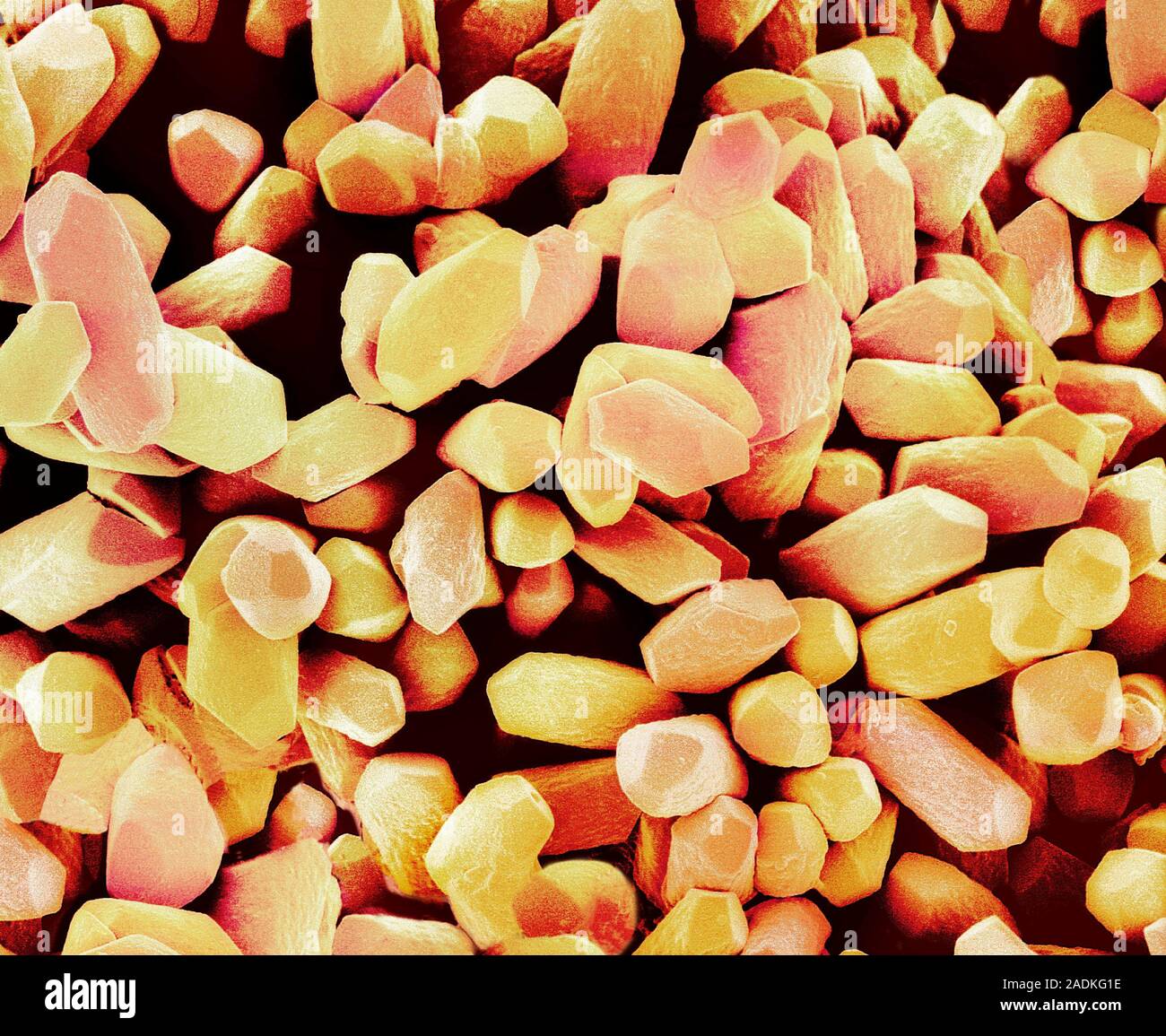 Calcium Carbonate Crystals In The Ear Otolithiasis NamuWiki