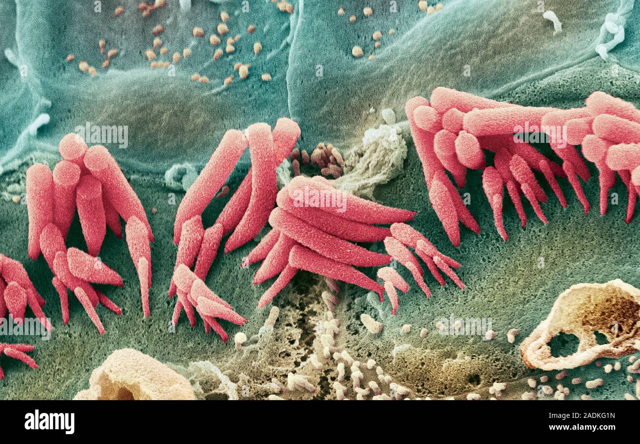 Inner ear hair cells. Coloured scanning electron micrograph (SEM) of ...