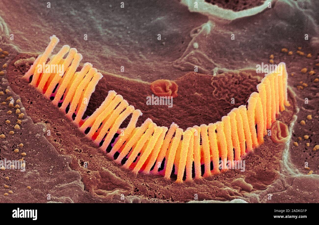 Inner ear hair cells. Coloured scanning electron micrograph (SEM) of ...