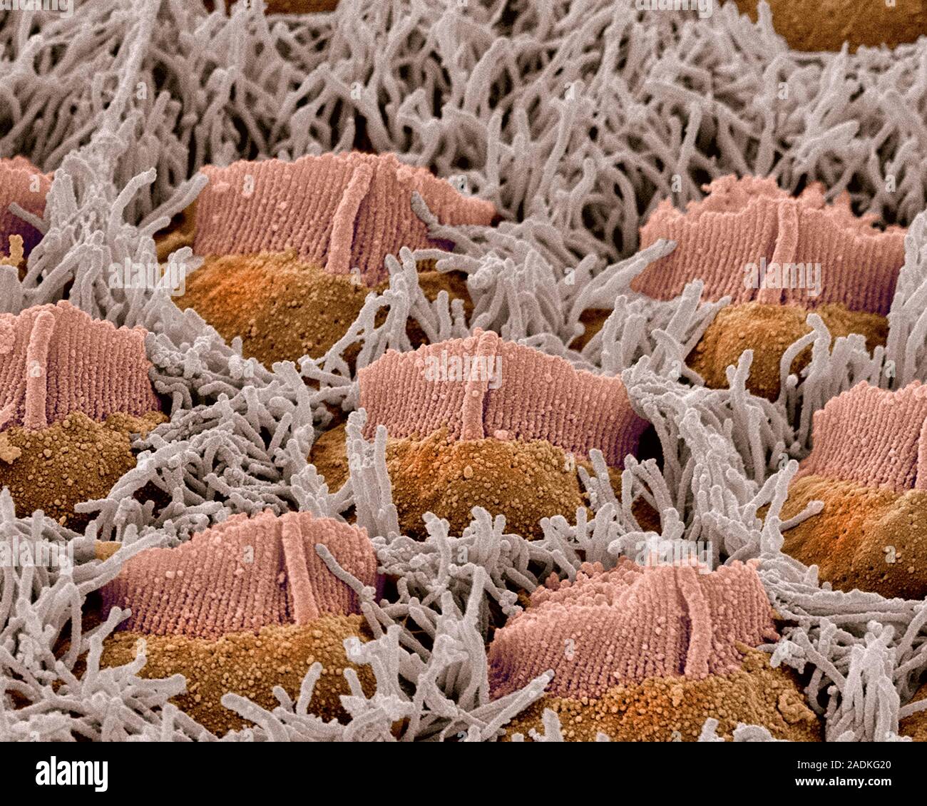 Foetal inner ear hair cells. Coloured scanning electron micrograph (SEM ... Foetal inner ear hair cells. Coloured scanning electron micrograph (SEM ...