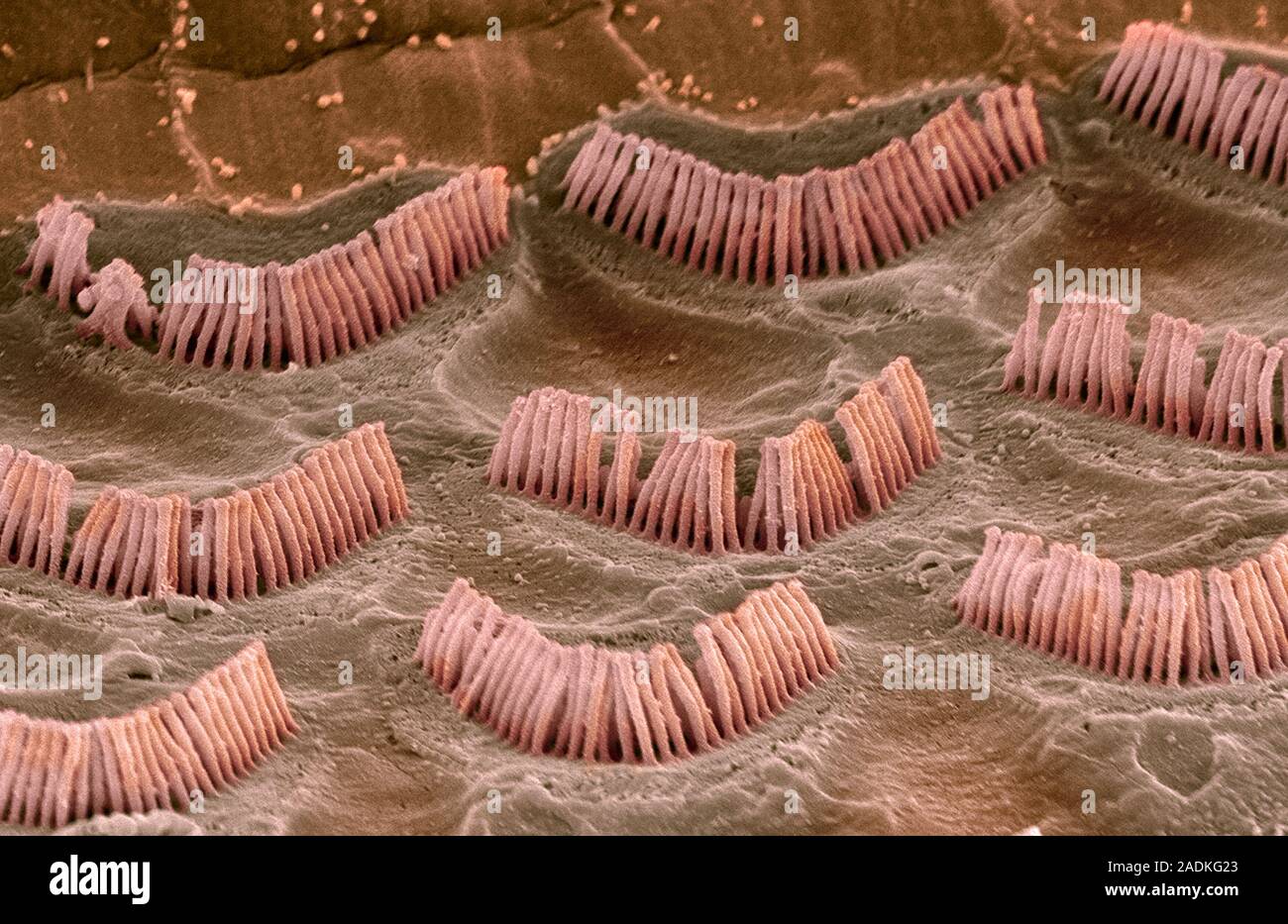Inner ear hair cells. Coloured scanning electron micrograph (SEM) of ... Inner ear hair cells. Coloured scanning electron micrograph (SEM) of ...