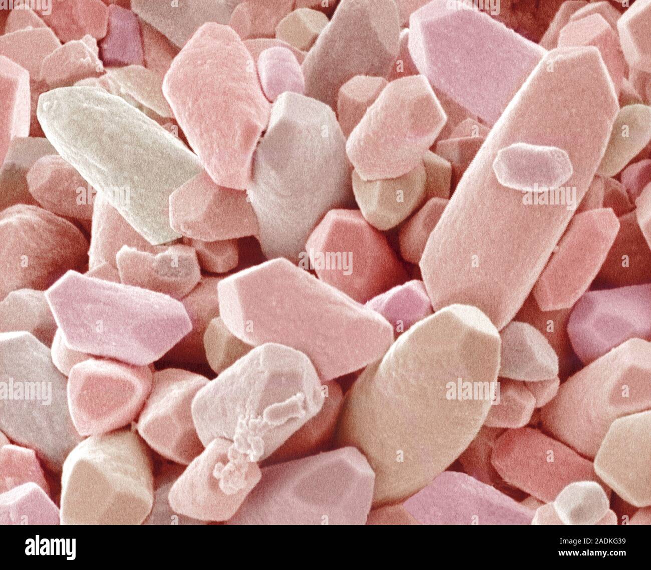 Balancing stone from inner ear. Coloured scanning electron micrograph ...