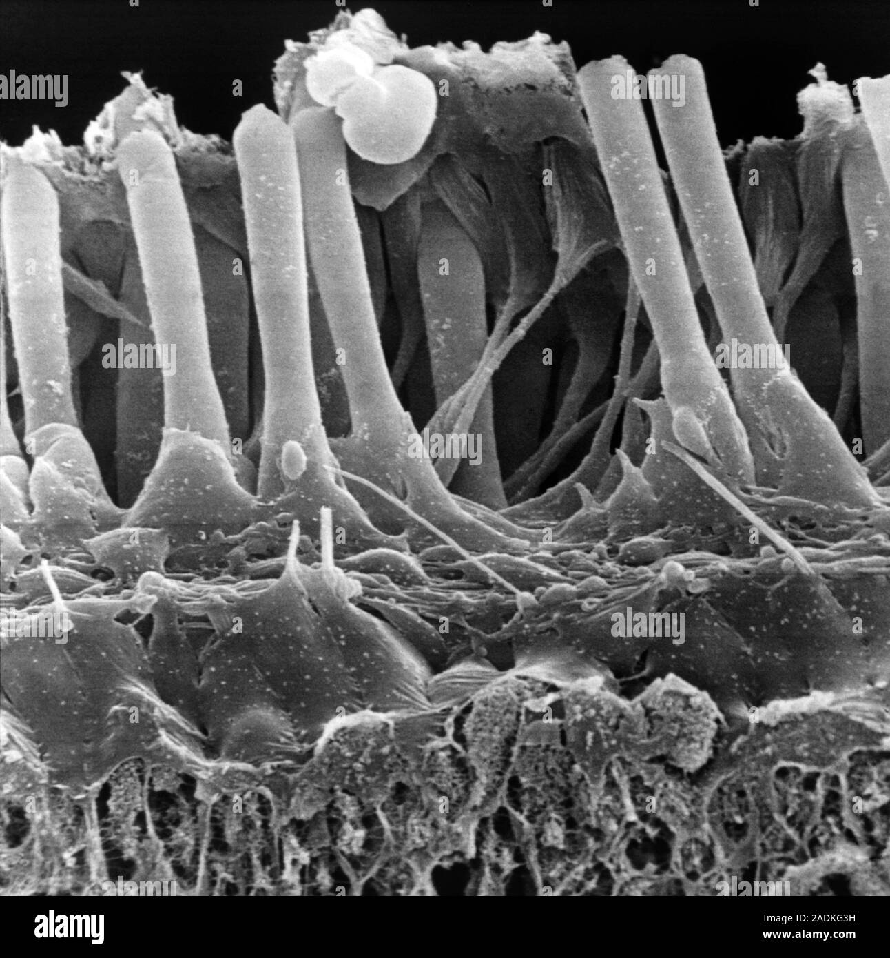 Normal inner ear hair cells. Scanning electron micrograph (SEM) of ...