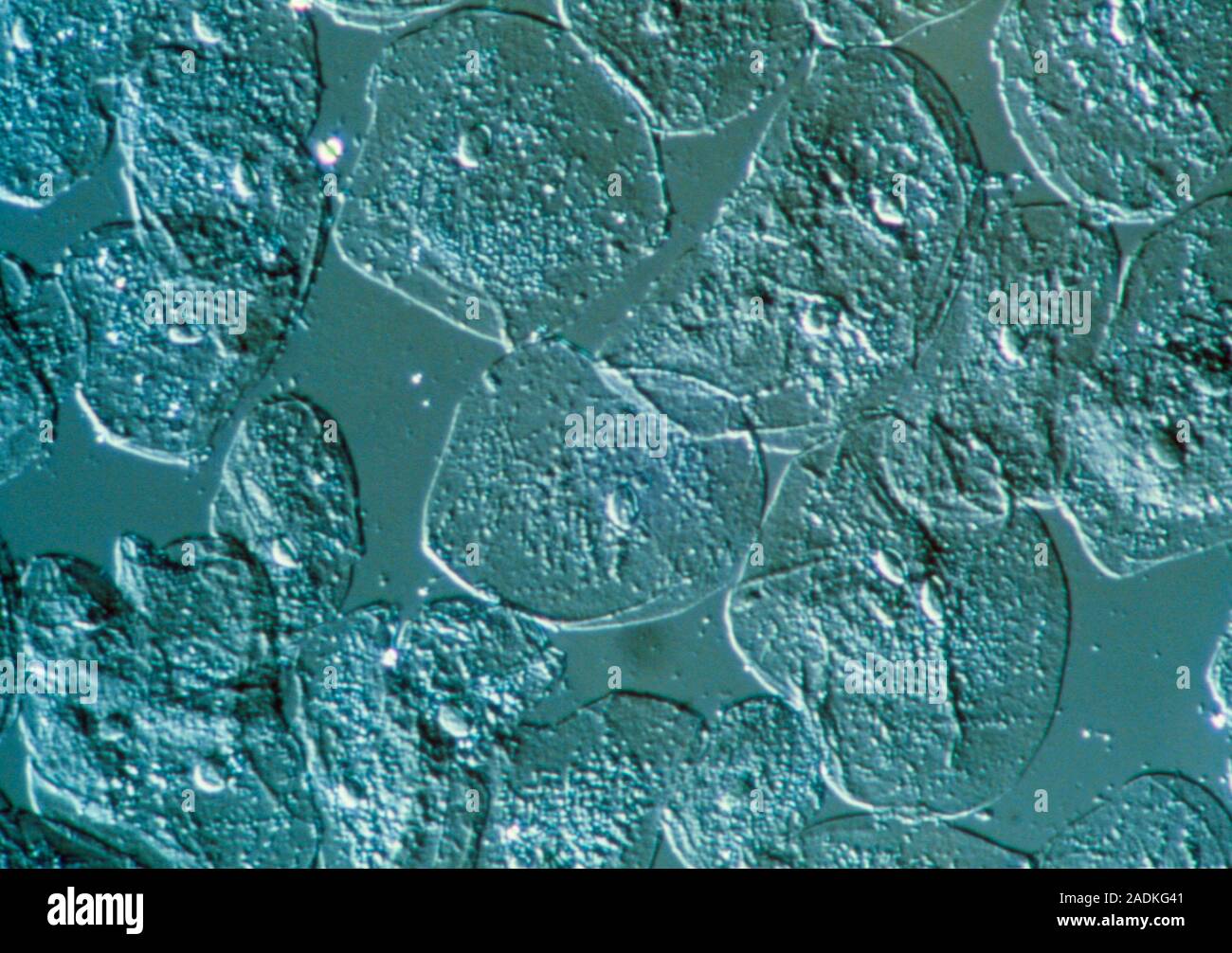 Cells of the mouth. Light micrograph of squamous (flat and scale-like ...