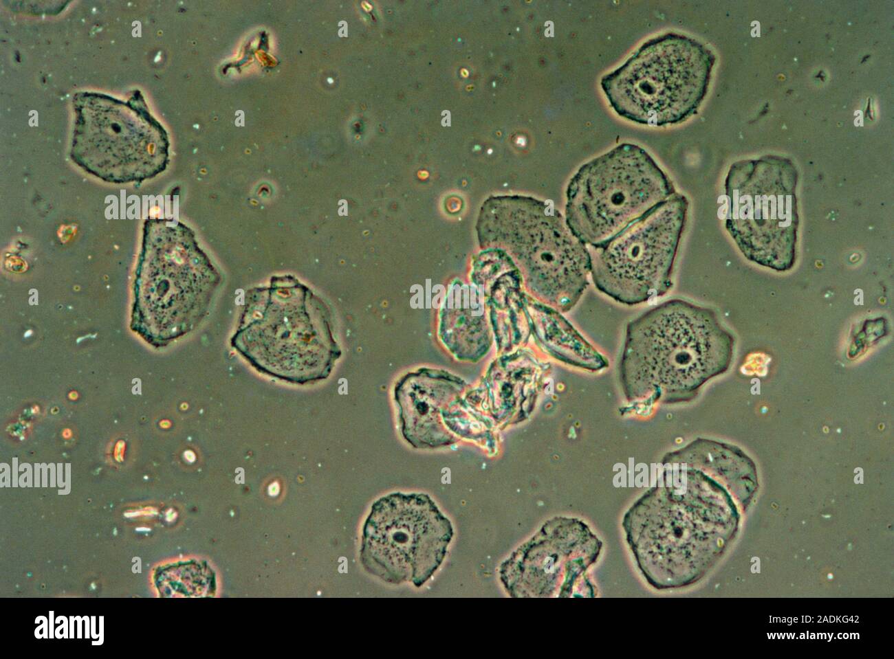 Cells of the mouth. Light micrograph of squamous (flat and scale-like ...