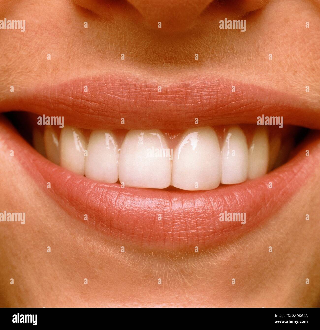 Teeth. Close-up of a woman's smiling mouth (seen in front view ...
