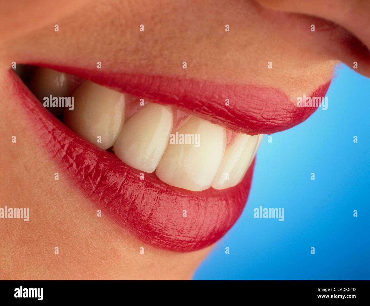 Teeth. Close-up of a woman's smiling mouth (seen in side view), showing ...