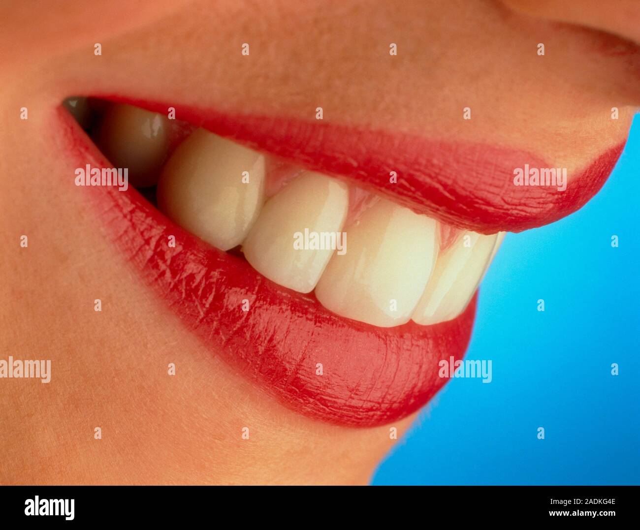 Teeth. Close-up of a woman's smiling mouth (seen in side view), showing ...