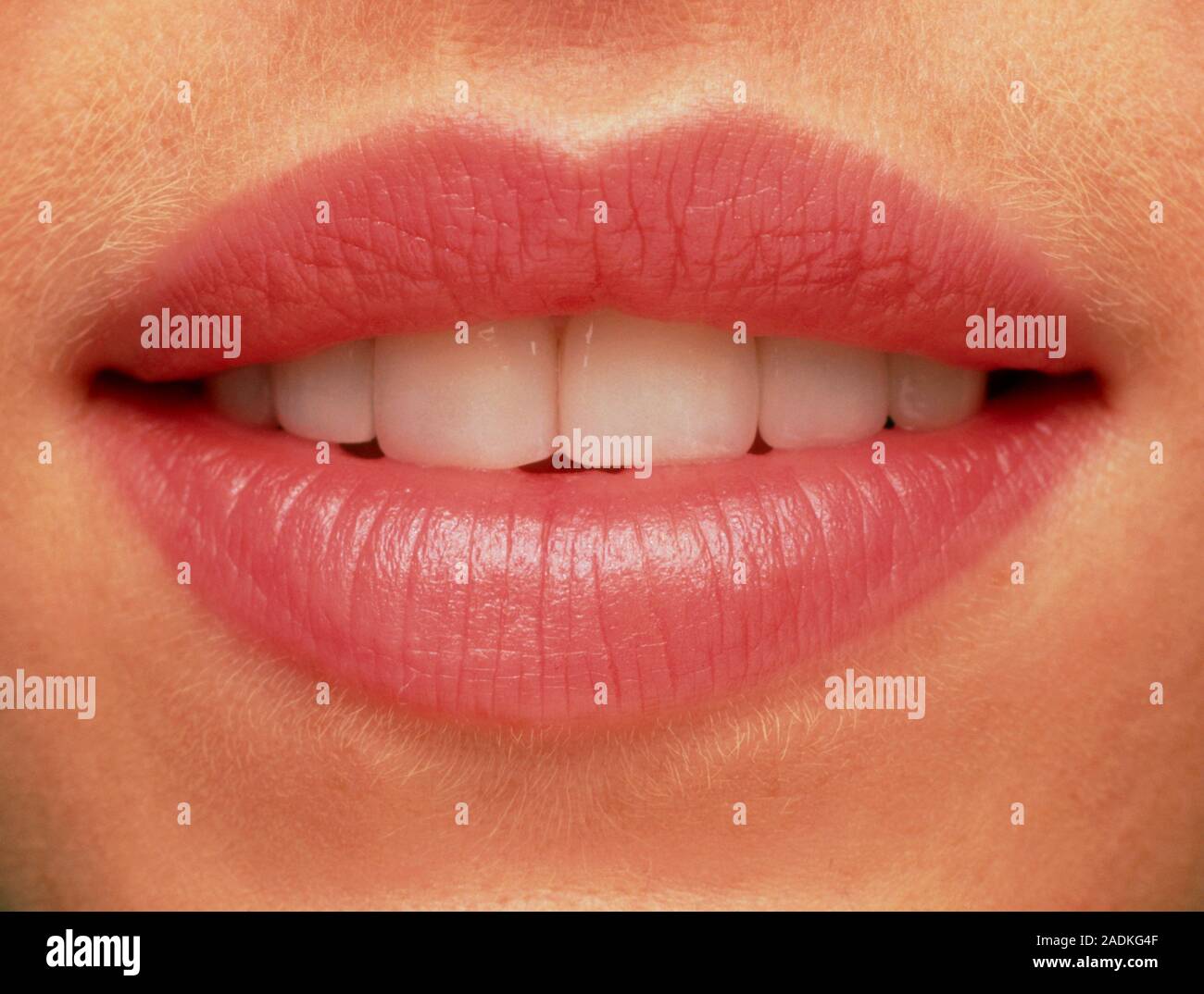 Teeth. Close-up of a woman's mouth (seen in front view), showing ...