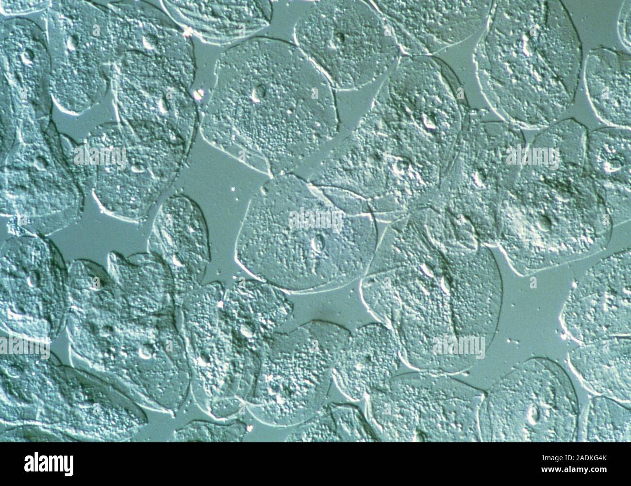 Cells of the mouth. Light micrograph of epithelial cells from the human ...