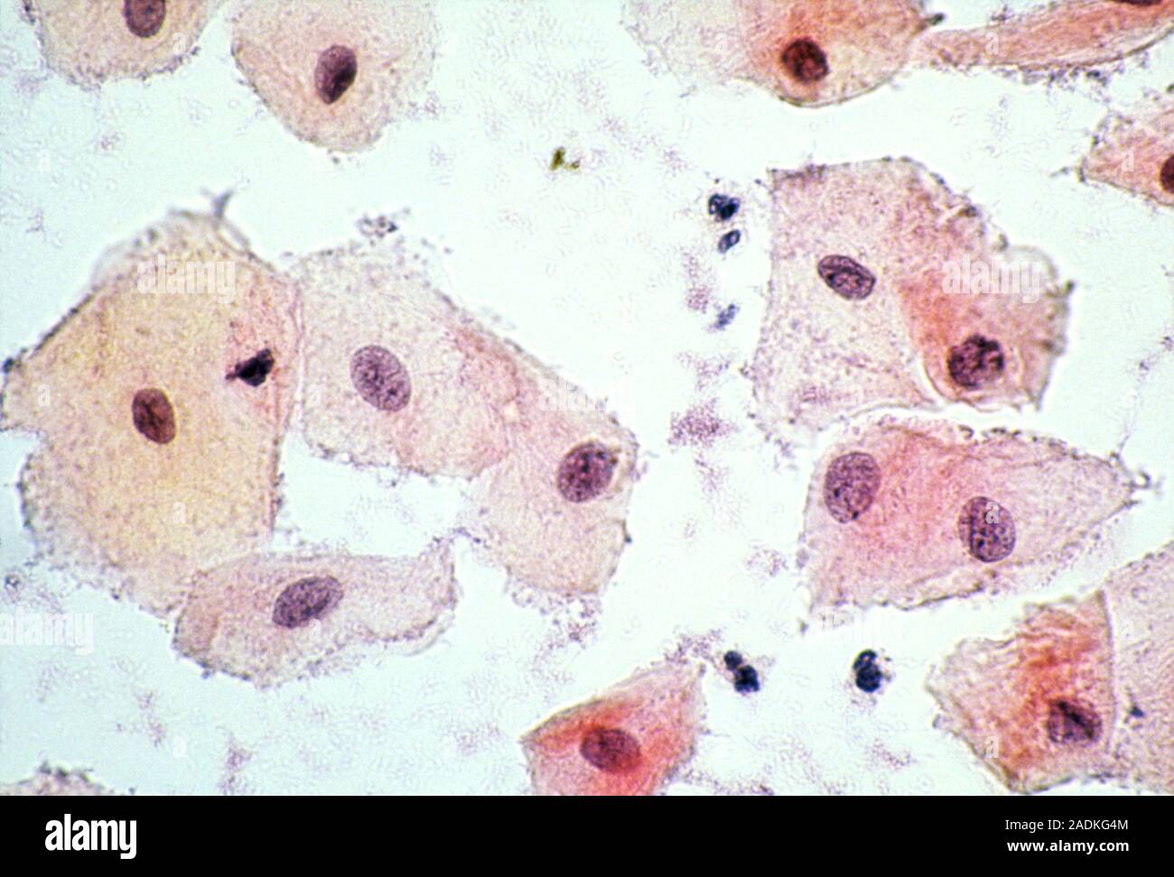 Cheek cells. Light micrograph of squamous epithelial cells from the ...