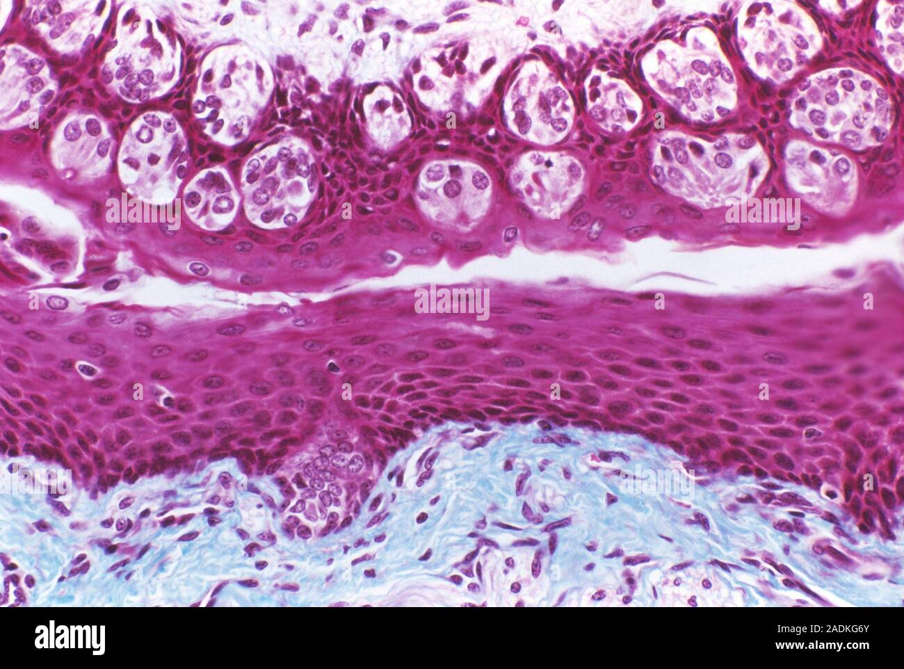 Tongue surface. Light micrograph of a section through a tongue surface ...