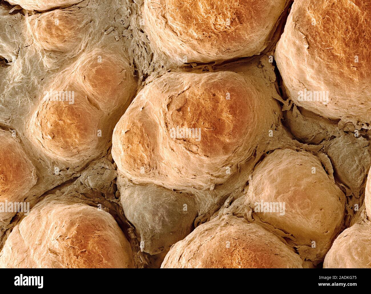 Tongue papillae. Coloured scanning electron micrograph (SEM) of ...