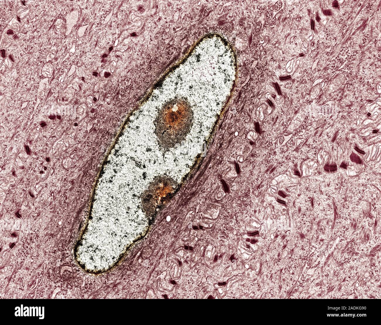 Cell nucleus. Coloured transmission electron micrograph (TEM) of a ...