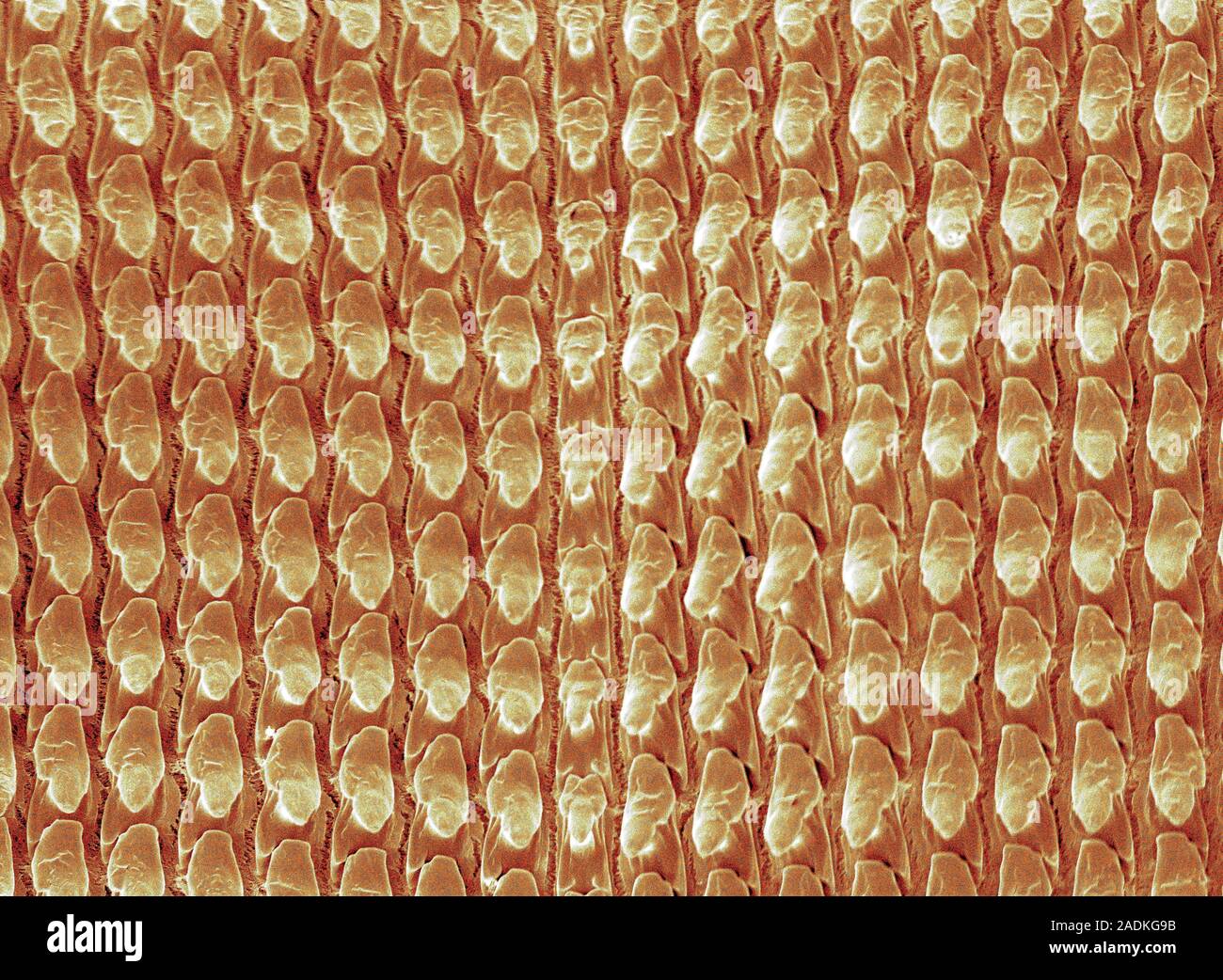 Snail radula. Coloured scanning electron micrograph (SEM) of the ...