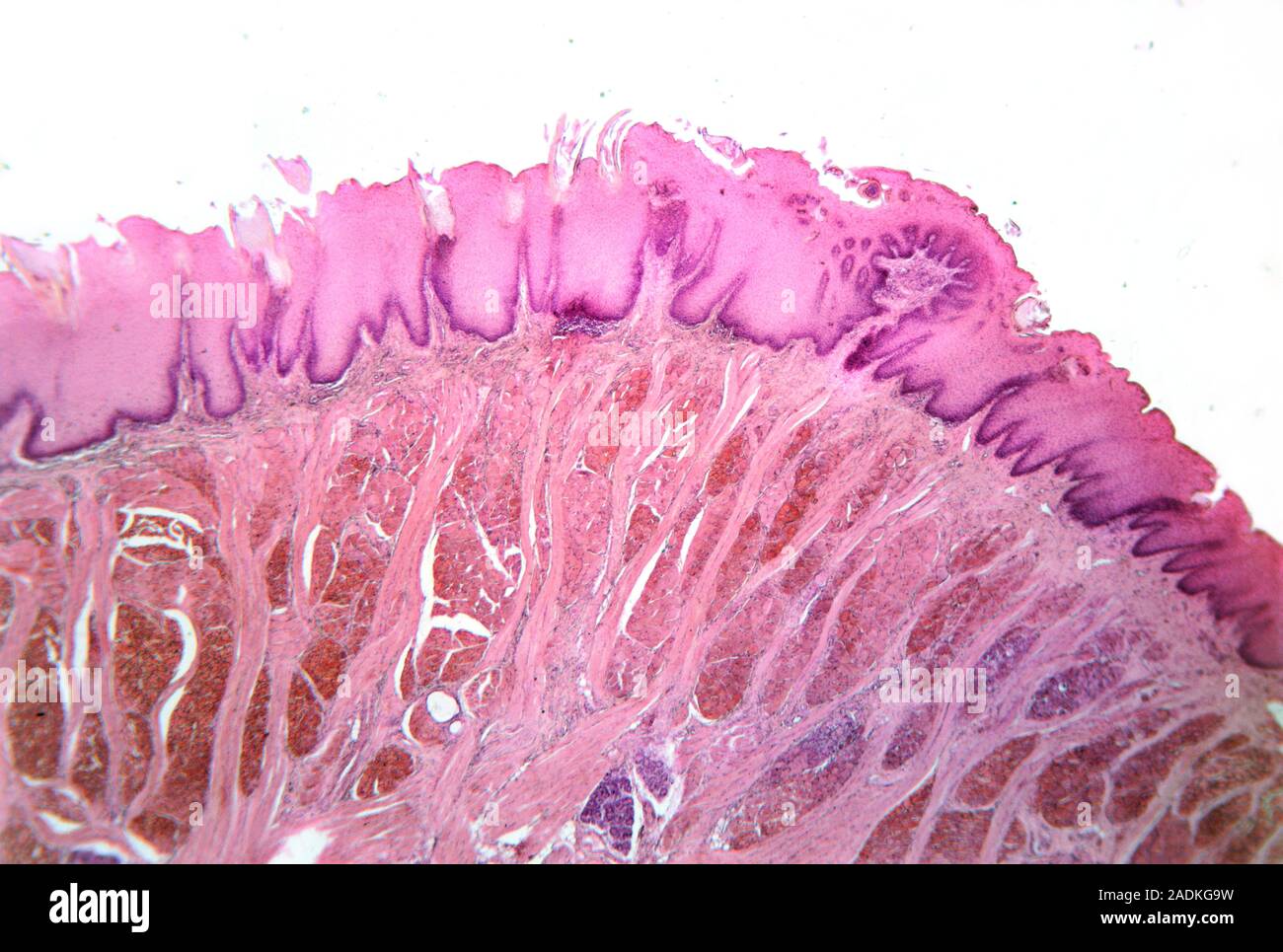 Light micrograph of a section through a human tongue. The body of the ...