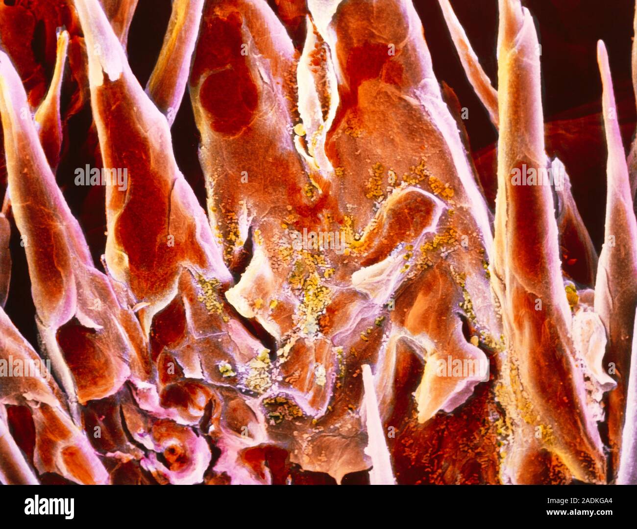 False-colour scanning electron micrograph (SEM) of filiform papillae on ...