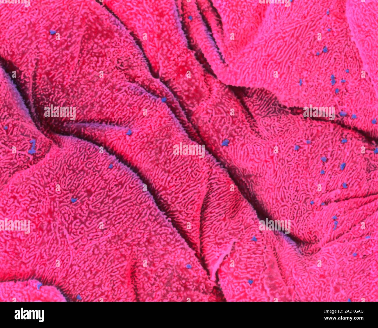 Tongue surface. Coloured scanning electron micrograph (SEM) showing ...